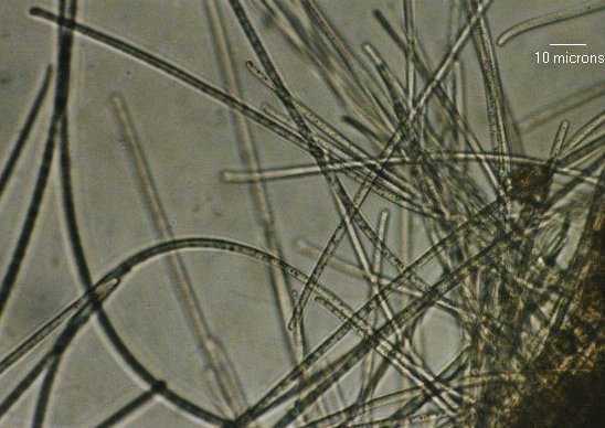 A. Prokaryonta (Akaryonta)