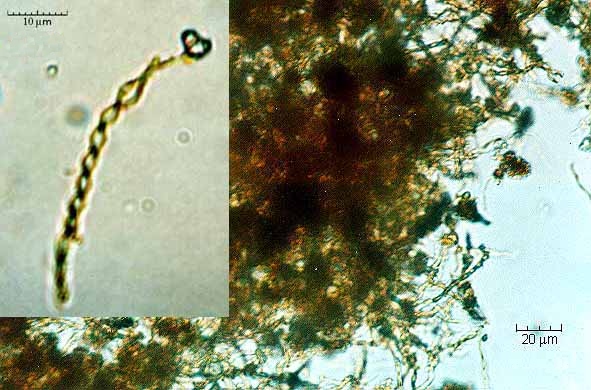 A. Prokaryonta (Akaryonta)