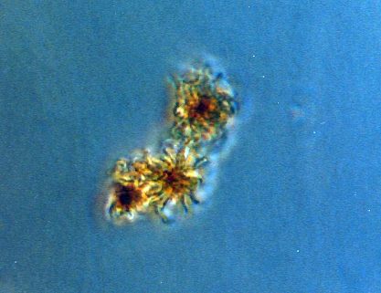 A. Prokaryonta (Akaryonta)