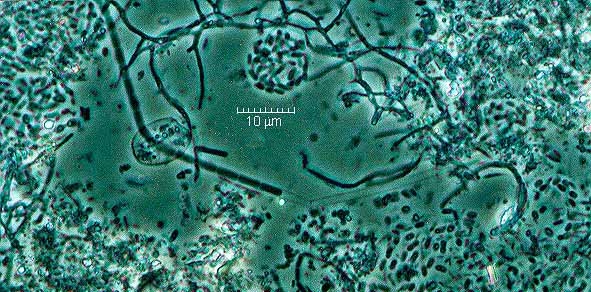 A. Prokaryonta (Akaryonta)