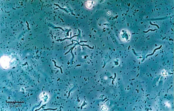 A. Prokaryonta (Akaryonta)