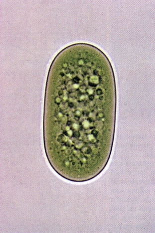 2 kmen CYANOPHYTA - sinice