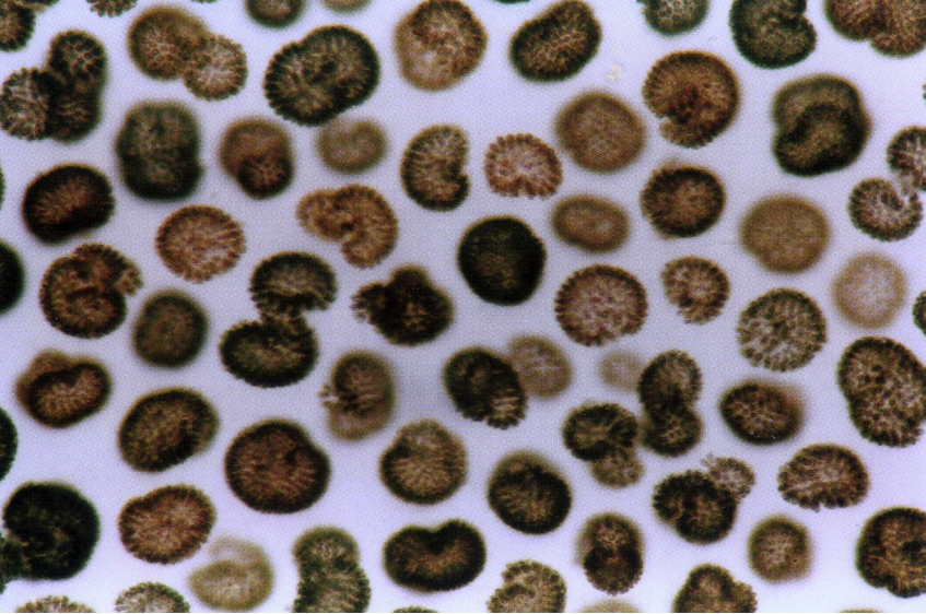 2 kmen CYANOPHYTA - sinice