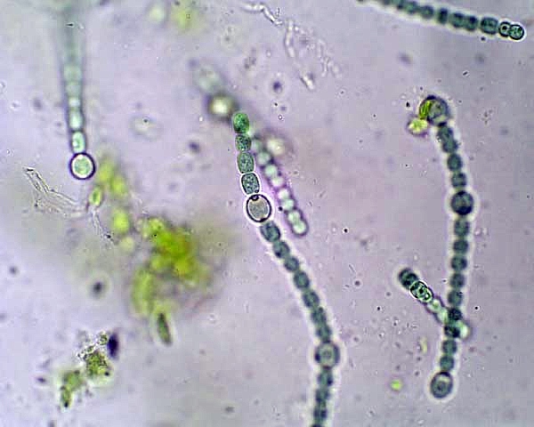 2 kmen CYANOPHYTA - sinice