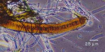 2 kmen CYANOPHYTA - sinice