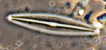 3 Bacillariophyceae - rozsivky