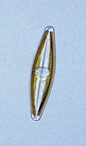 3 Bacillariophyceae - rozsivky