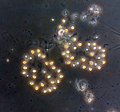 5. kmen CHLOROPHYTA - zelené řasy