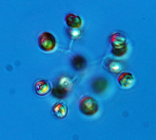 5. kmen CHLOROPHYTA - zelené řasy