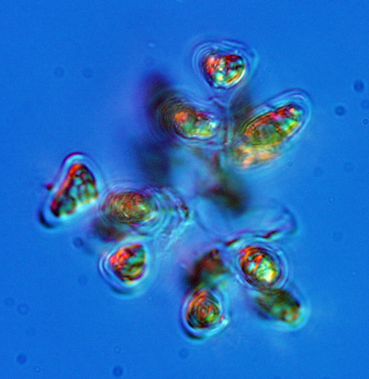 5. kmen CHLOROPHYTA - zelené řasy