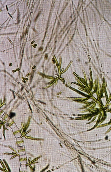 5. kmen CHLOROPHYTA - zelené řasy
