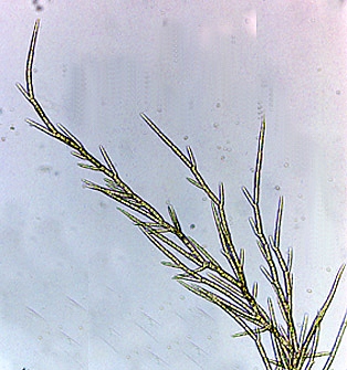 5. kmen CHLOROPHYTA - zelené řasy