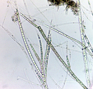 5. kmen CHLOROPHYTA - zelené řasy