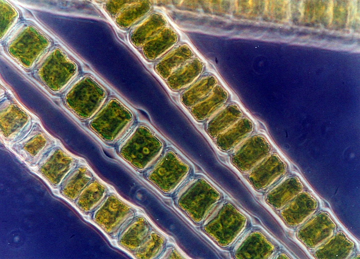 5. kmen CHLOROPHYTA - zelené řasy